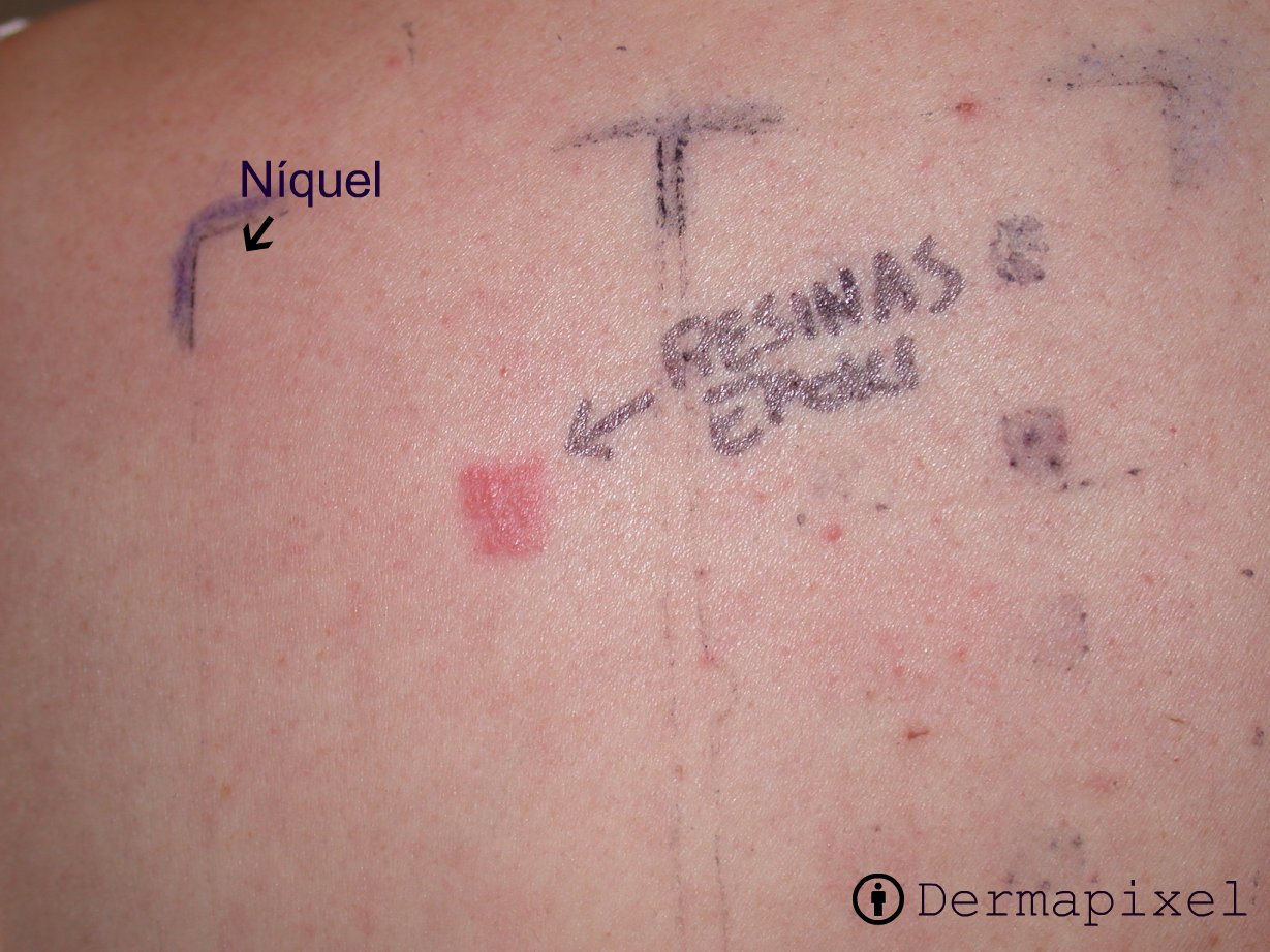 Dermapixel: marzo 2011