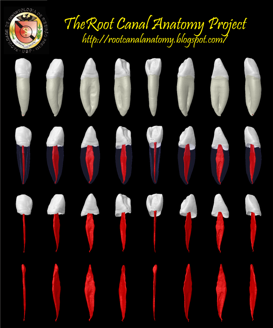 The Root Canal Anatomy Project Mandibular Incisors
