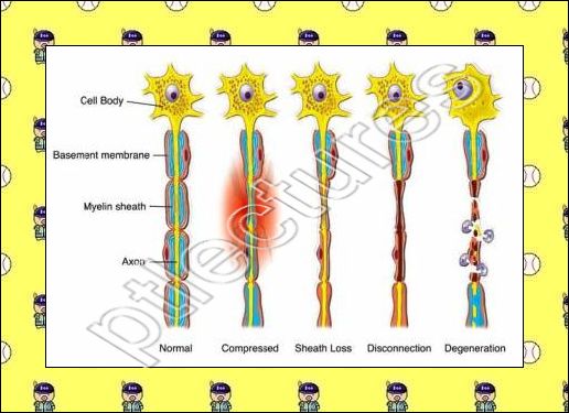 Lectures in Physical Therapy: Nerve Injuries