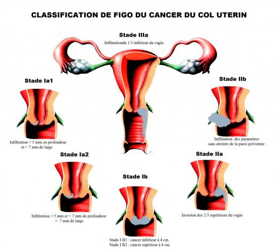 Taille Du Col De Lutérus Pendant La Grossesse Partager Taille Bonne