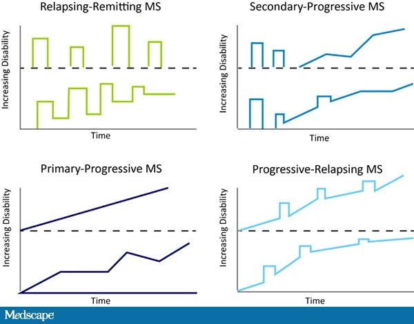 Multiple Sclerosis: Types of MS