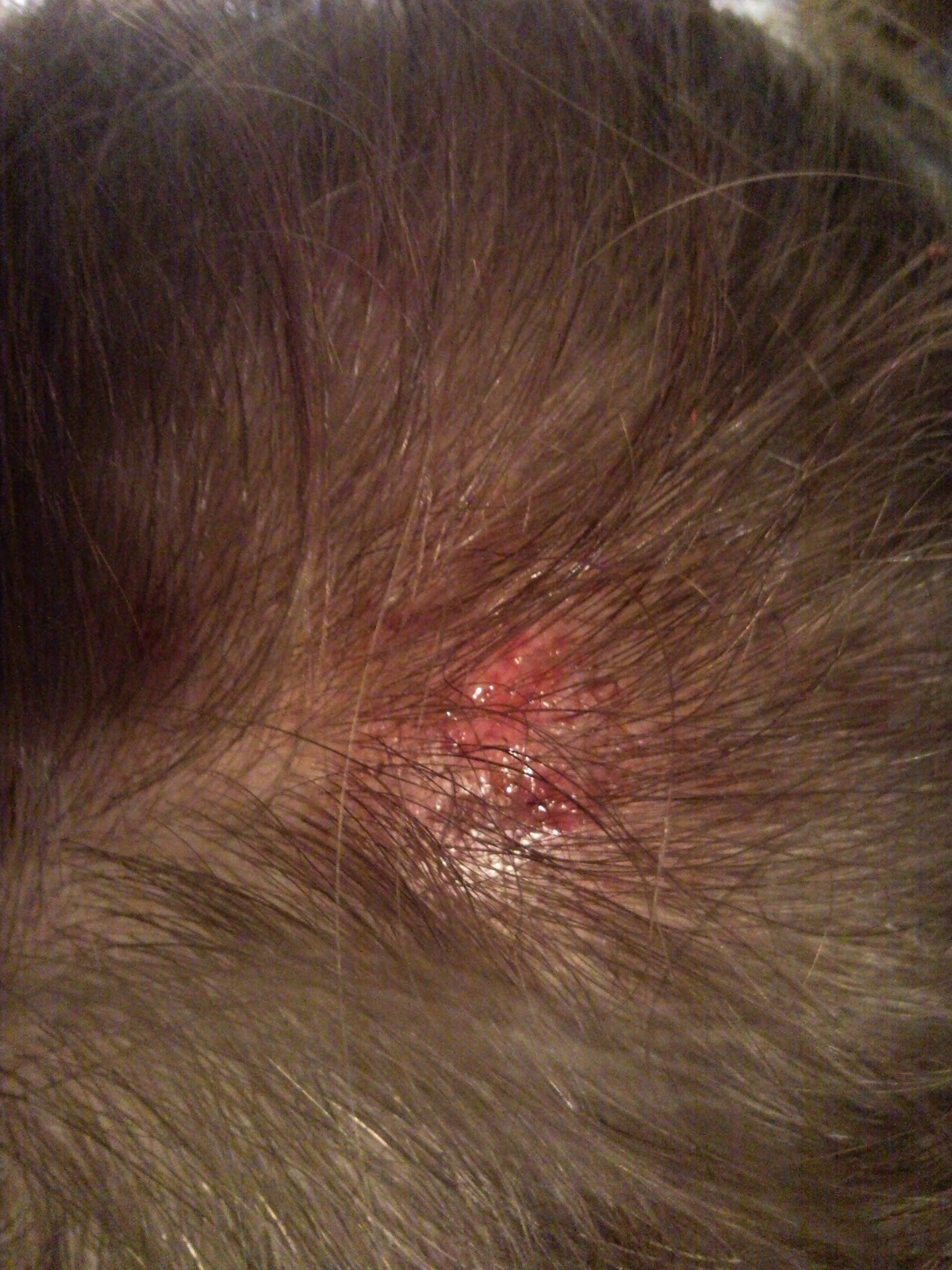 25 Images Mites On Face And Scalp Demodectic Mange