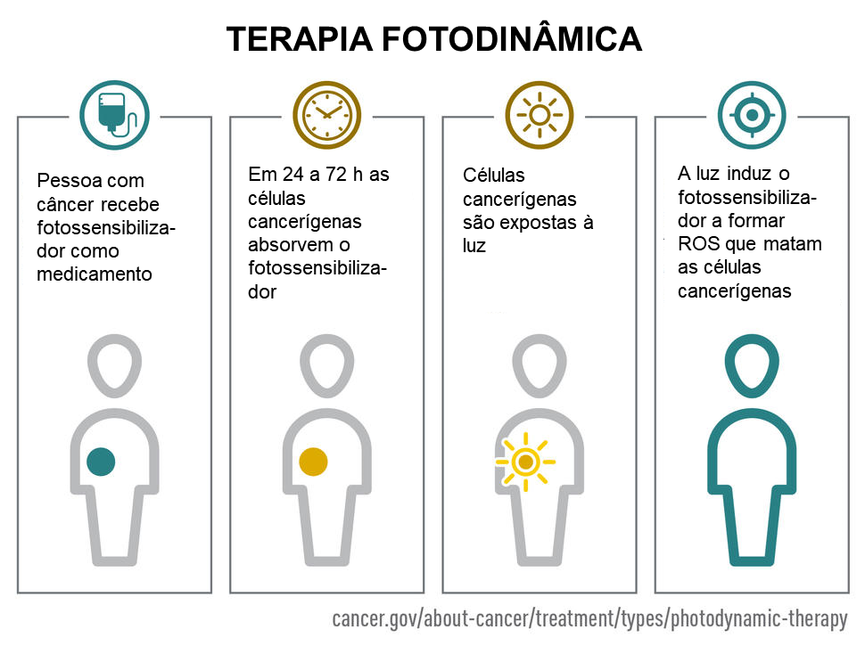 Terapia Fotodinâmica Alternativa Para O Tratamento De Infecções